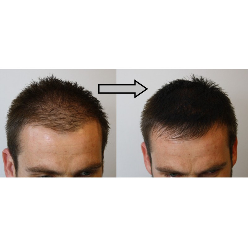 Púder na zahustenie riedkych vlasov, zakrytie odrastov a šedín Color ...